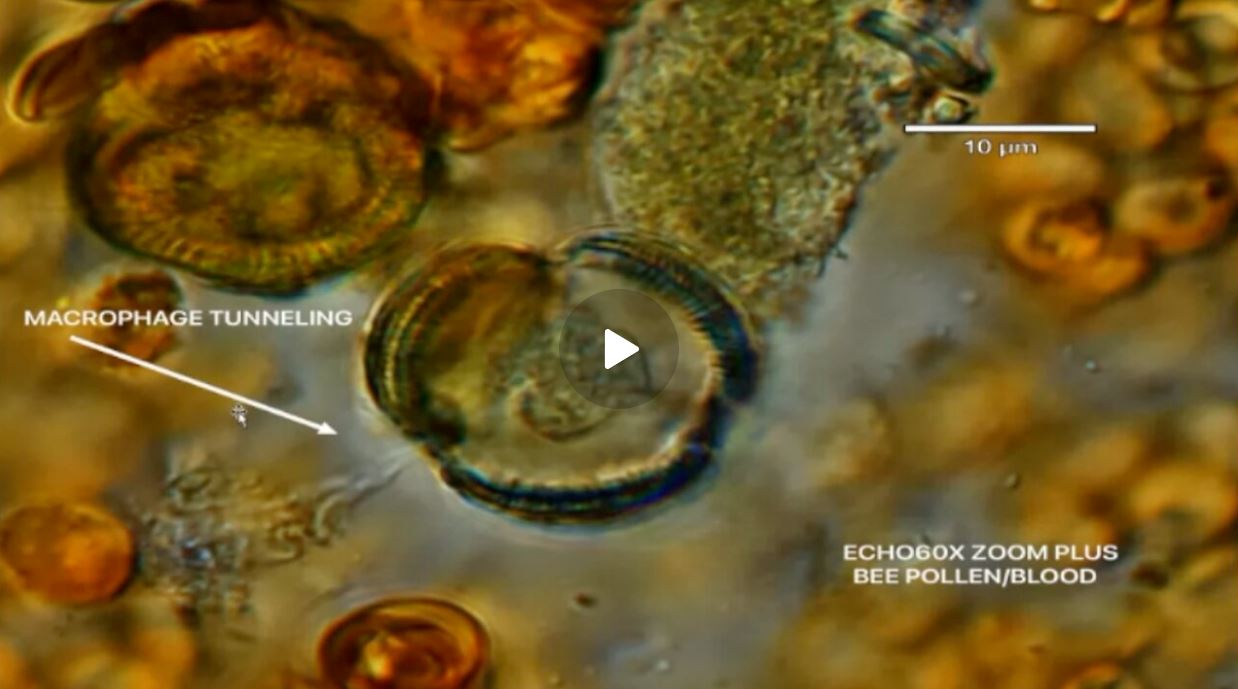 Lee Merritt MD interviews scientists Maria Crisler on Hydrogel ...