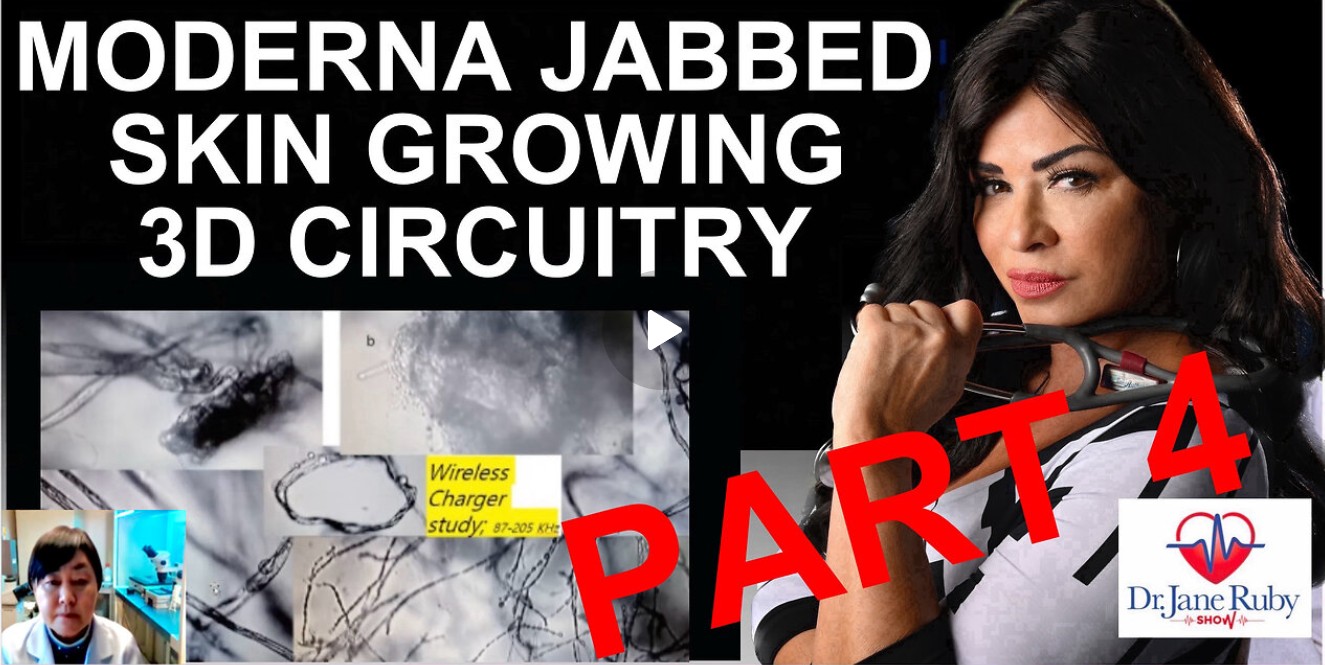 PART 4: PFIZER/MODERNA JABBED SKIN GROWING CIRCUITRY - HopeGirl Blog